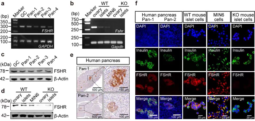 妇产科医院/生殖与发育研究院黄荷凤团队揭示FSH调节胰岛素分泌和糖稳态新机制